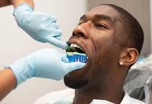 Dentist Invisalign Near Me | Invisalign Before And After Pictures